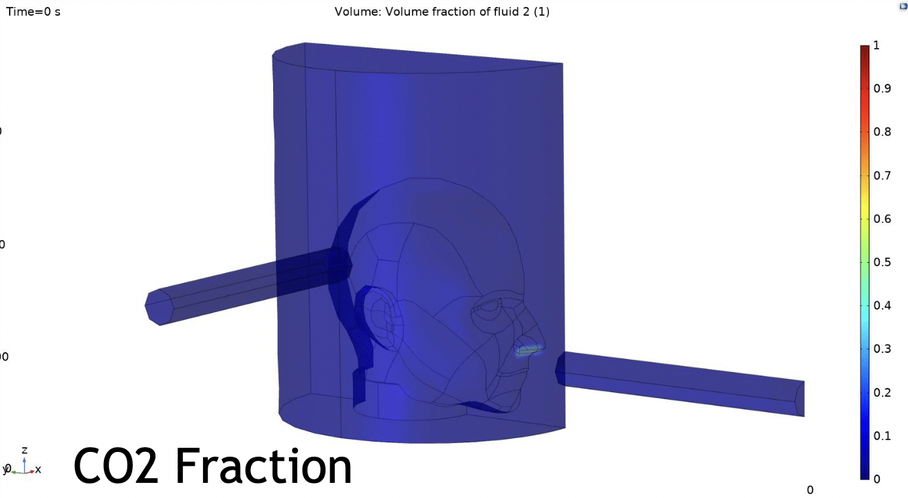 Development of Helmet-Patient Interface for Non-Invasive Ventilation ...